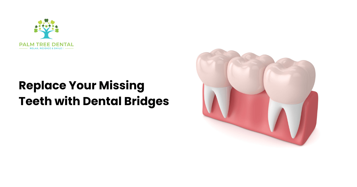 Replace Your Missing Teeth with Dental Bridges | Palm Tree Dental Replace Your Missing Teeth with Dental Bridges | Palm Tree Dental